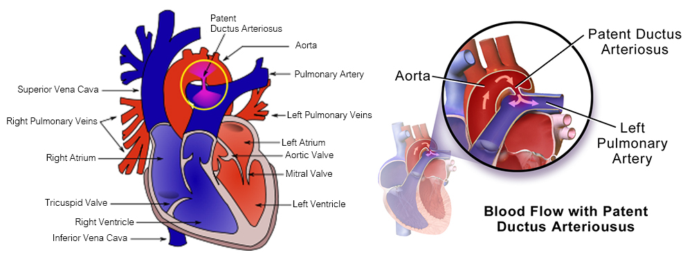 ภาวะหลอดเลือดหัวใจเกิน Patent Ductus Arteriosus (PDA) - บ้านและสวน Pets